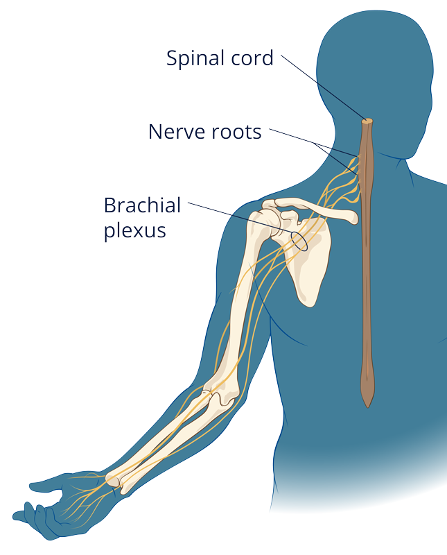 Broken Plexus (1 of 3): Designing a Recovery Workbook to Work Out ...